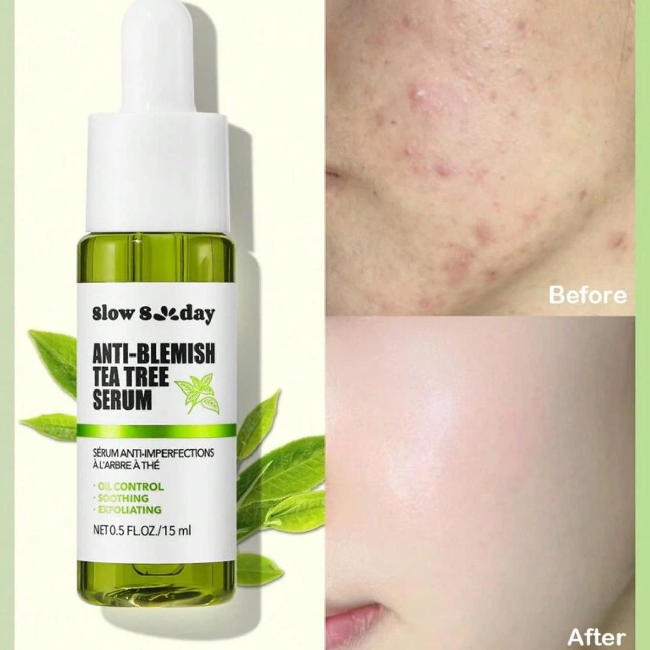 Anti-Blemish Tea Tree Serum - soothes and calms... - Depop