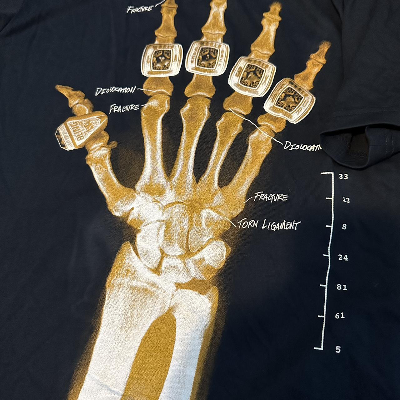 Nike Kobe Bryant broken hand x-ray Dri-fit... | Depop